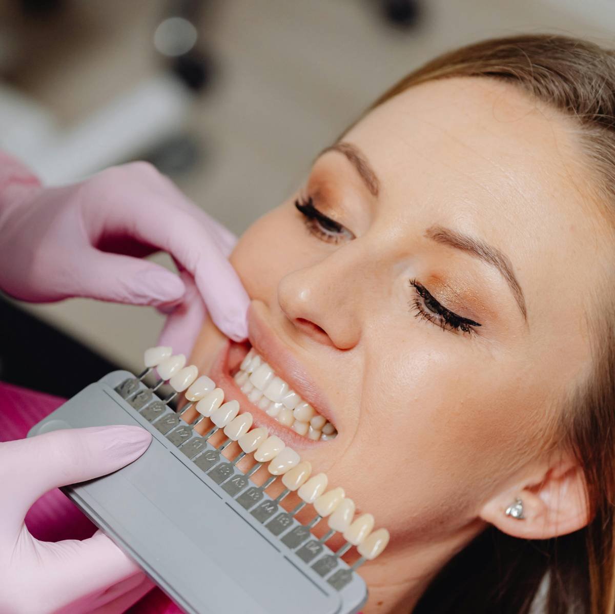 Crowns | Melbourne Dental Clinic | Best Dentist Clinics
